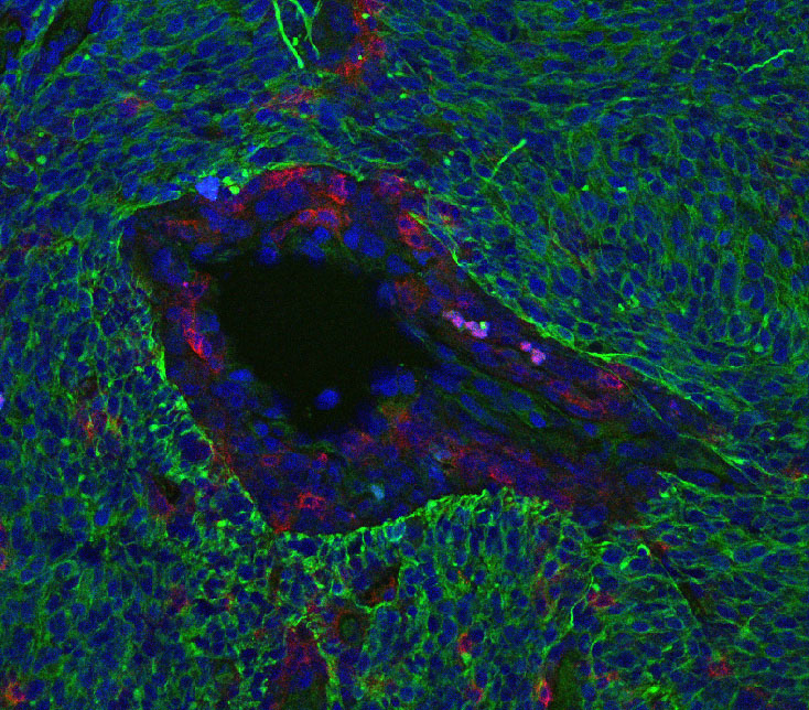 11th MIC confocal microscopy course | Molecular Imaging Center (MIC) | UiB