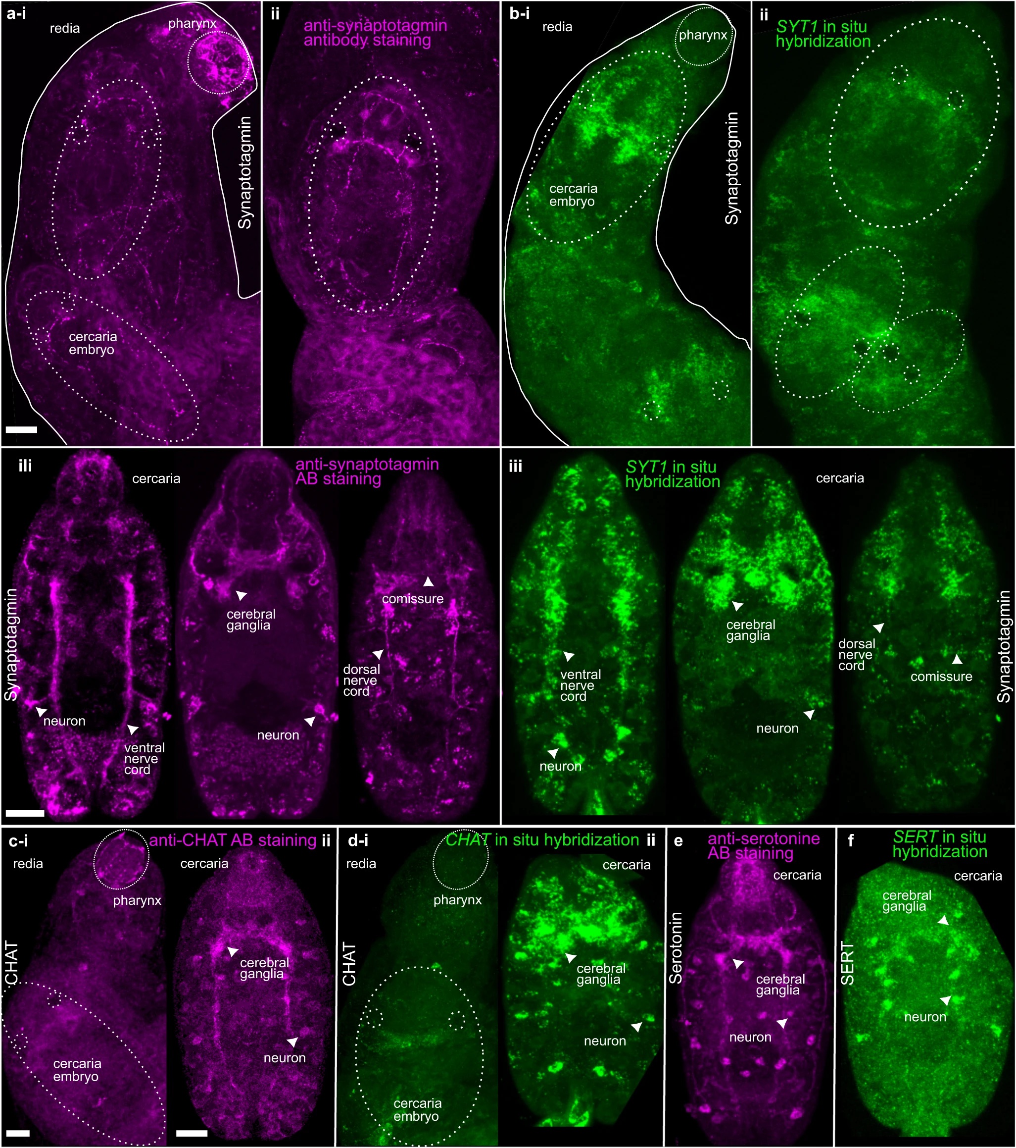 A first look at the plastic nervous system of a cod parasite | Michael ...