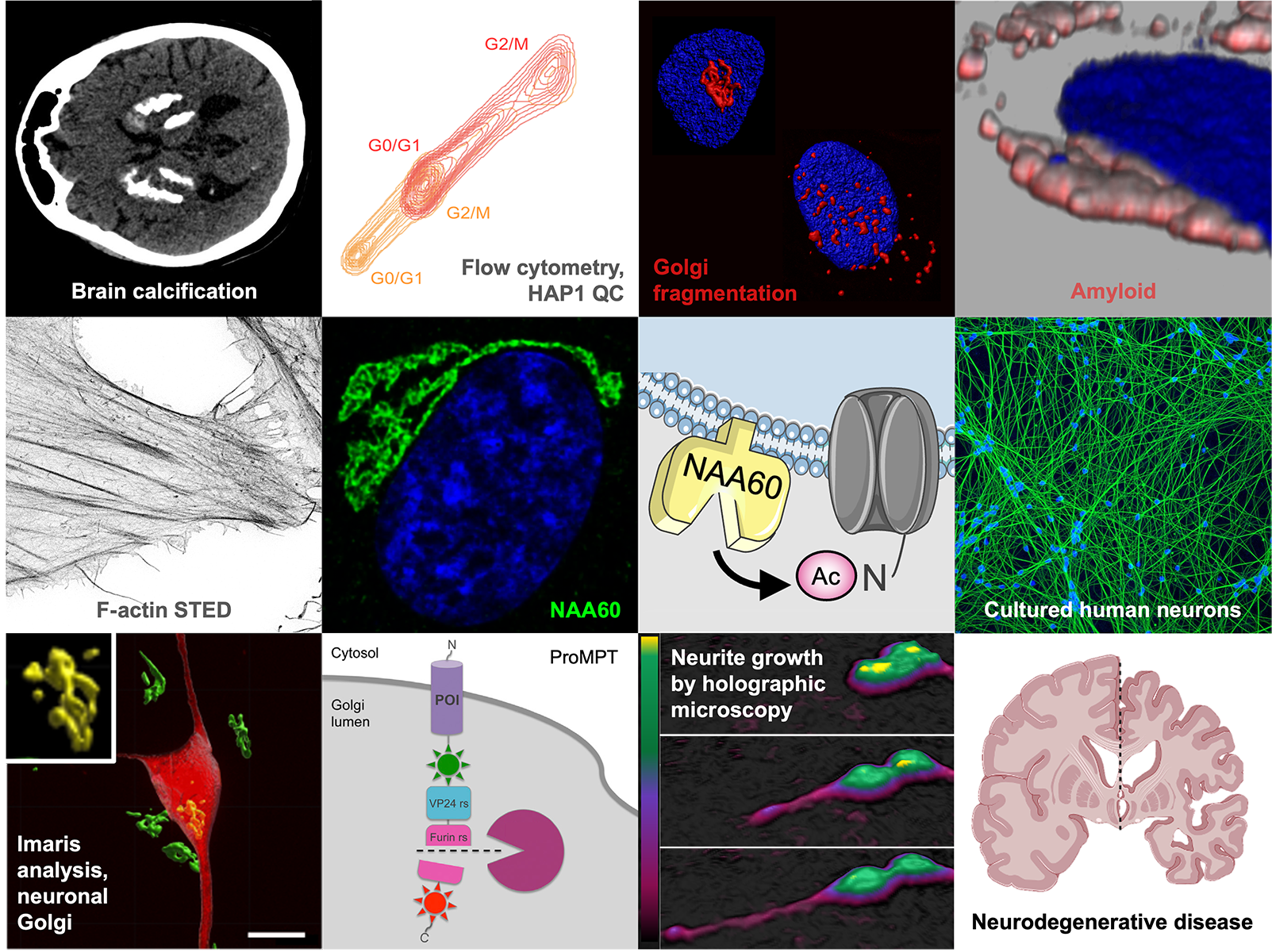 MemBrain – Membranproteiner i hjernen | Universitetet i Bergen
