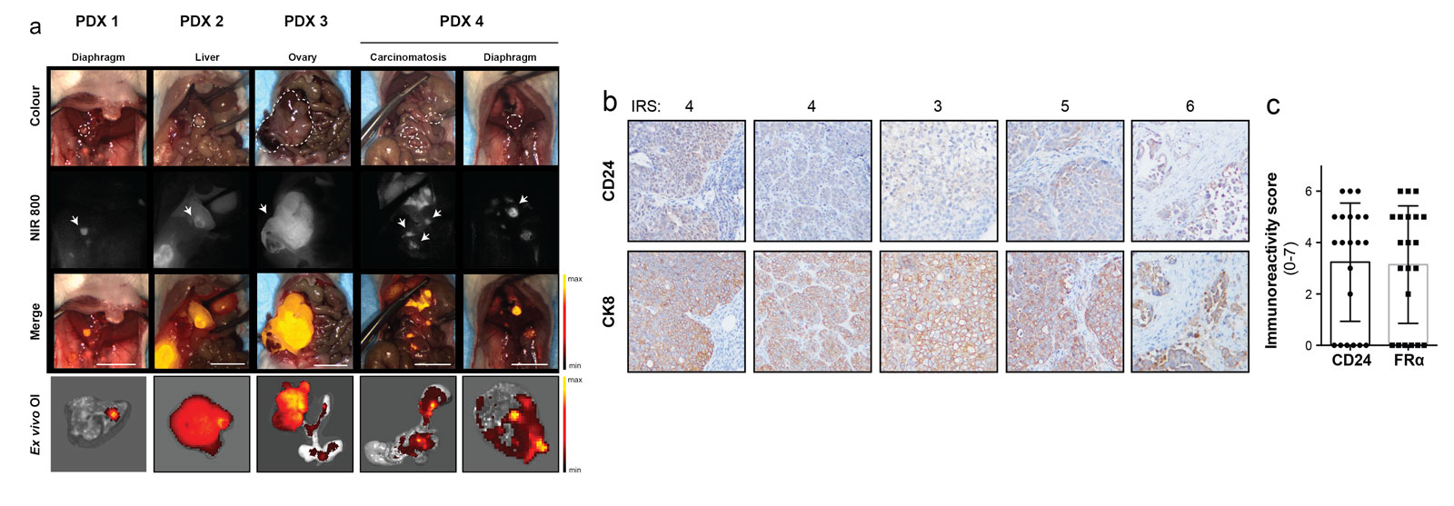 Image guided cytoreduction of ovarian cancer | Centre for Cancer ...