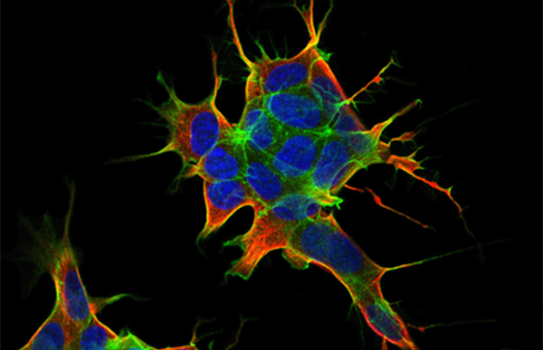 Translational Cell Signaling and Metabolism | University of Bergen