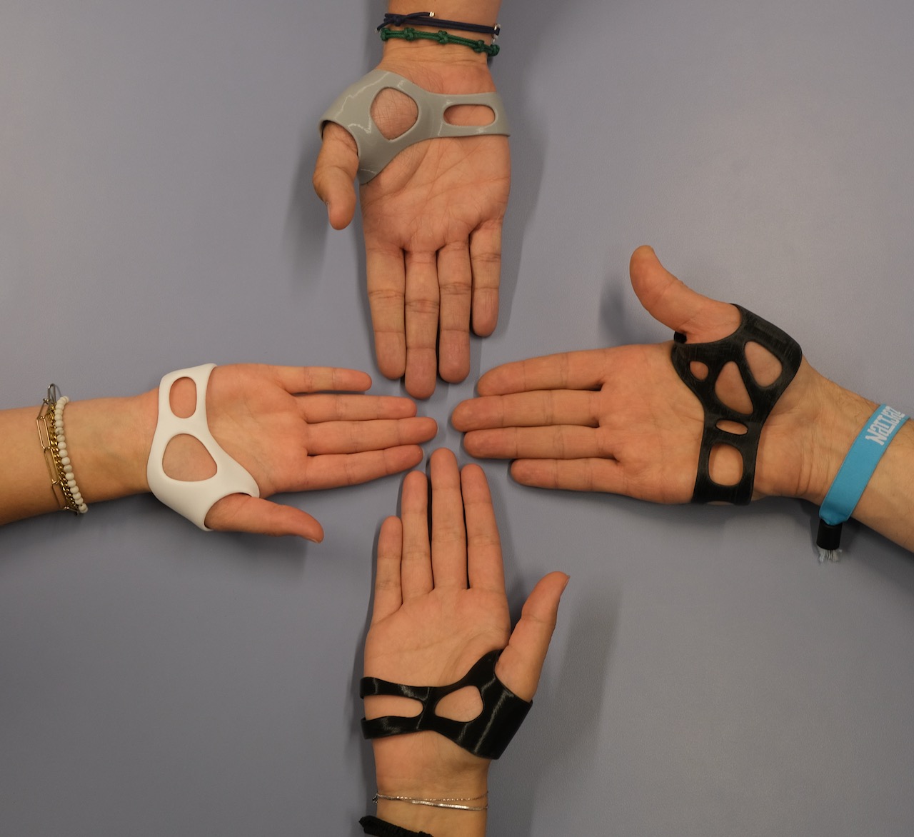 Personalized orthopedic splints with 3D technology | Biomaterials | UiB