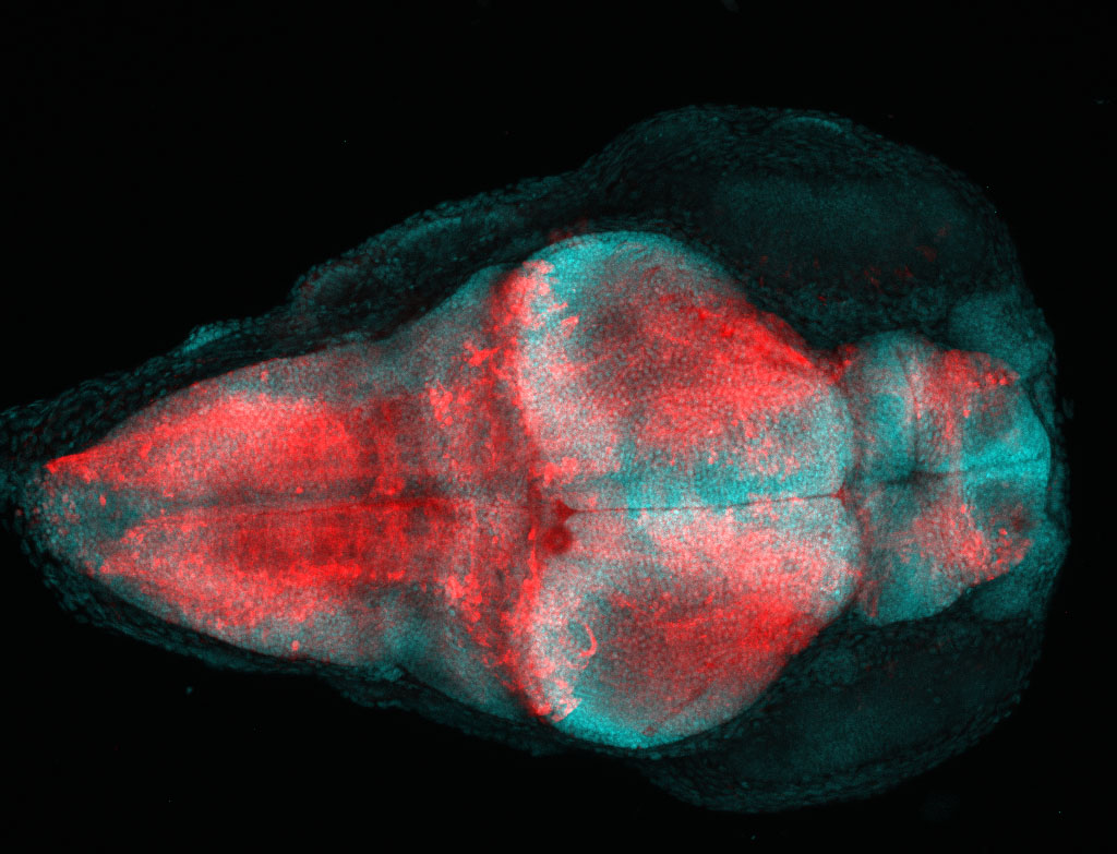 Cell stress | University of Bergen