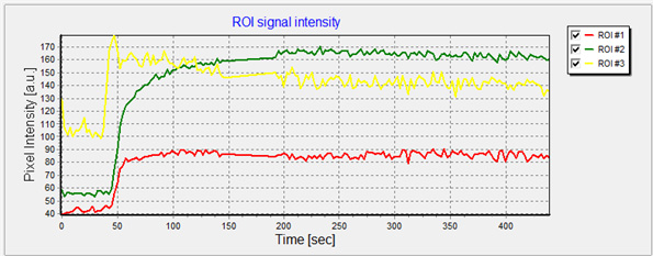 Main research areas | Bergen Cancer Imaging Research Group (BCIRG) | UiB