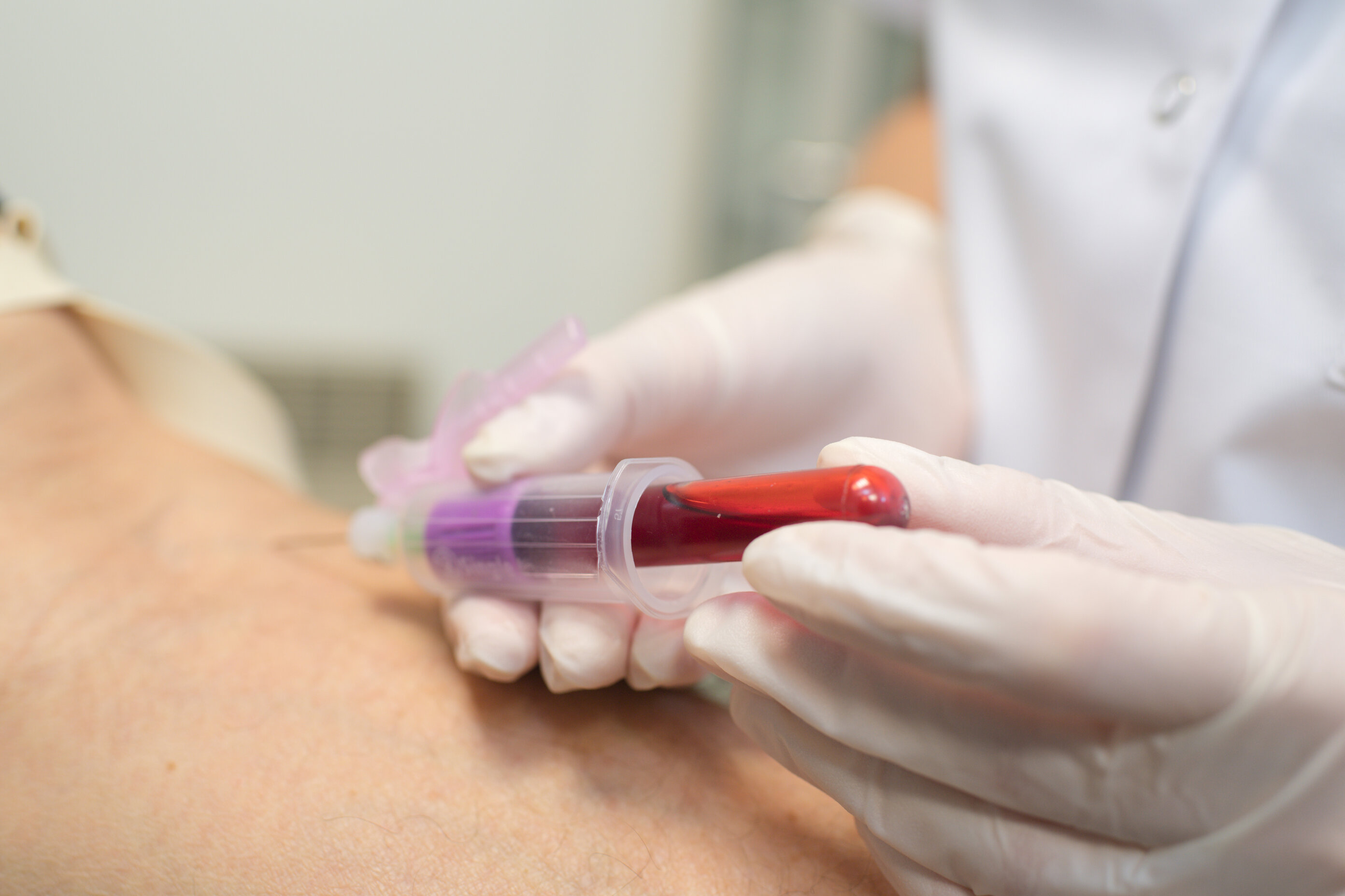 Blodprøve tatt timer etter cellegift forutsier overlevelse | Det ...