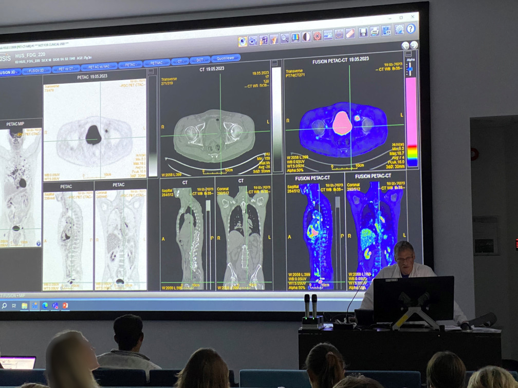 Multimodal imaging | Radiology and Nuclear Medicine at UiB | UiB