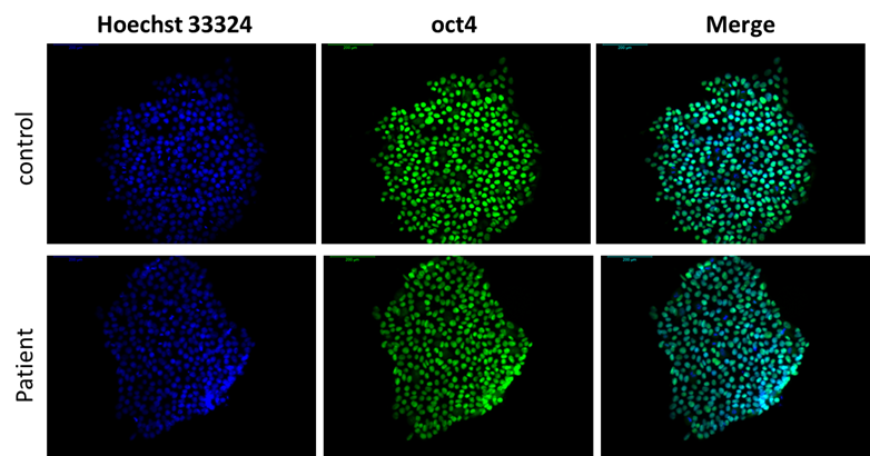 Mitochondrial Stem cell research | Mitochondrial Medicine ...