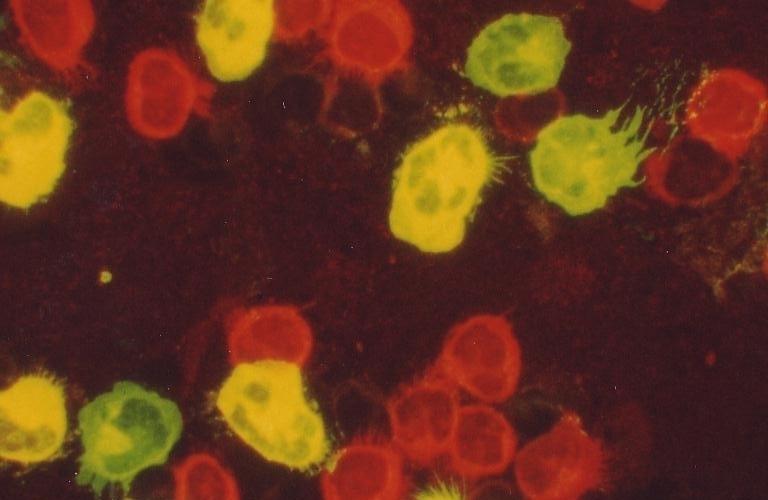 Fish Immunology Research | Fish immunology | UiB