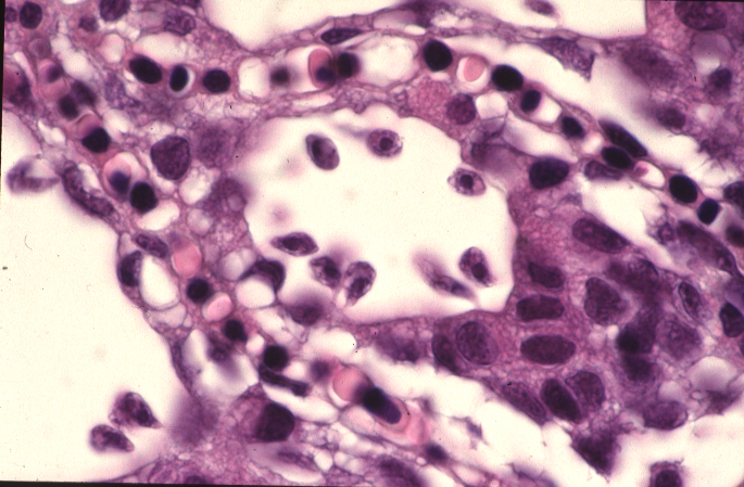 Ichthyobodo spp. – a large complex of sibling species | Fish Disease ...