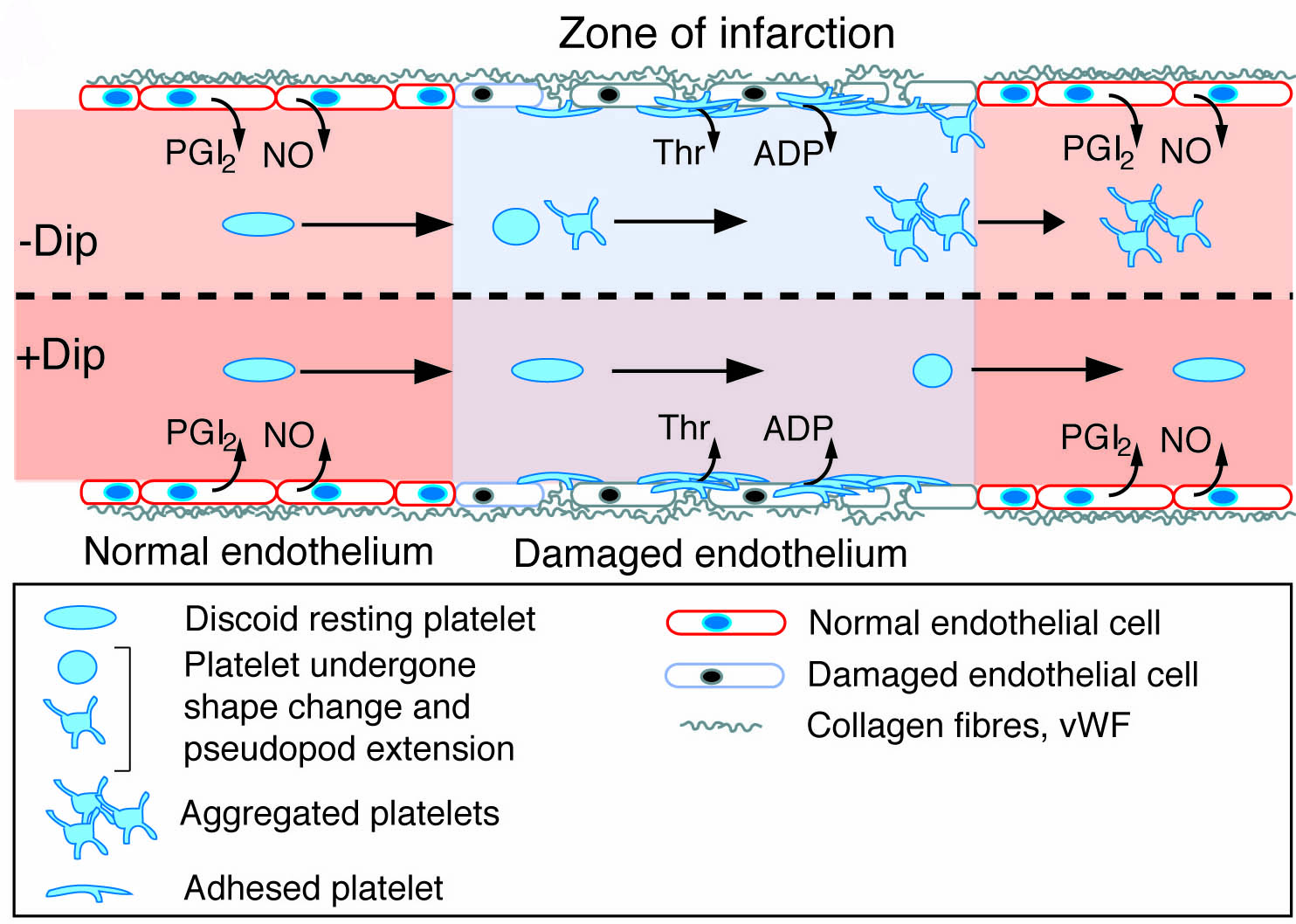 A role for platelet shape change in the efficiency of aspirin/dipyridamole treatment of stroke ...