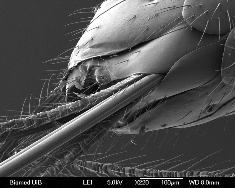 Transmission electron microscopy - TEM | Molecular Imaging Center (MIC ...