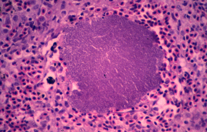 Bacteriology | Fish Disease Research Group - FDRG | UiB