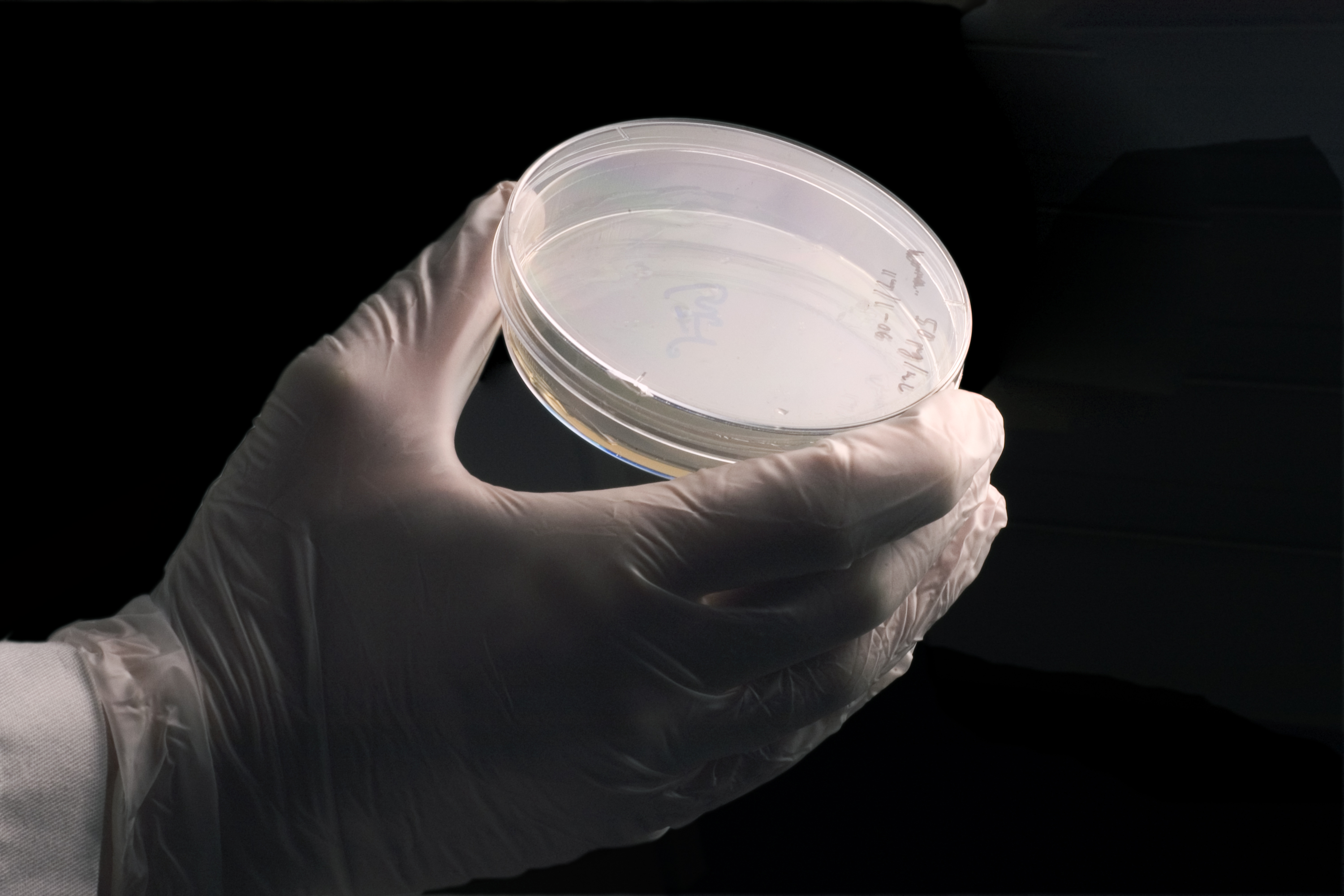 Laboratory Methods | PROBE | UiB