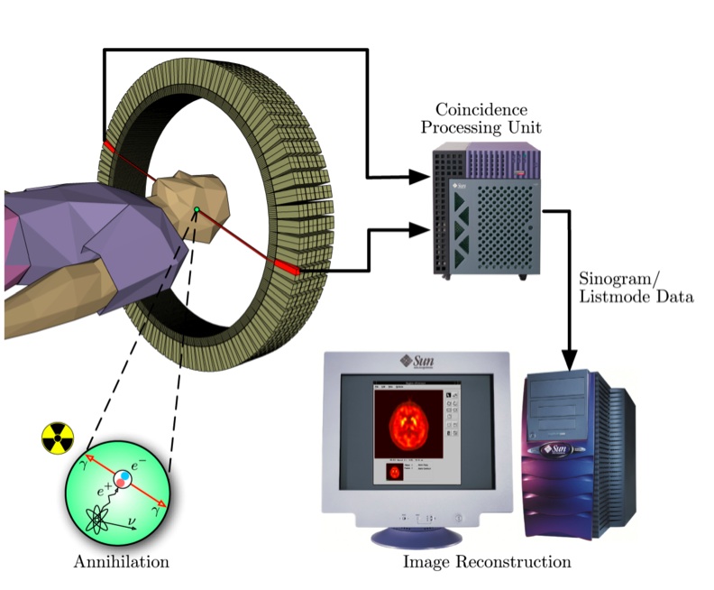 PET Imaging og time of flight (ToF) | Matematisk institutt | UiB